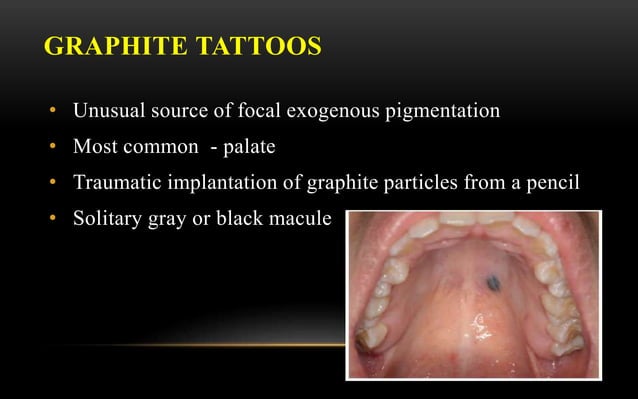 Pigmentations of the oral cavity | PPTX