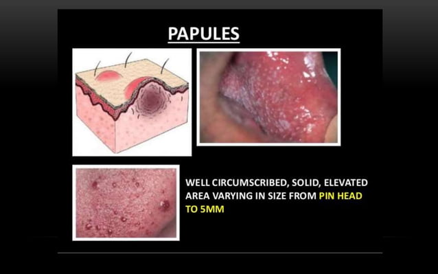 Pigmentations of the oral cavity | PPTX