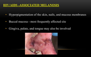 Pigmentations of the oral cavity | PPTX