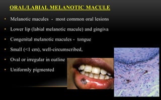 Pigmentations of the oral cavity | PPTX