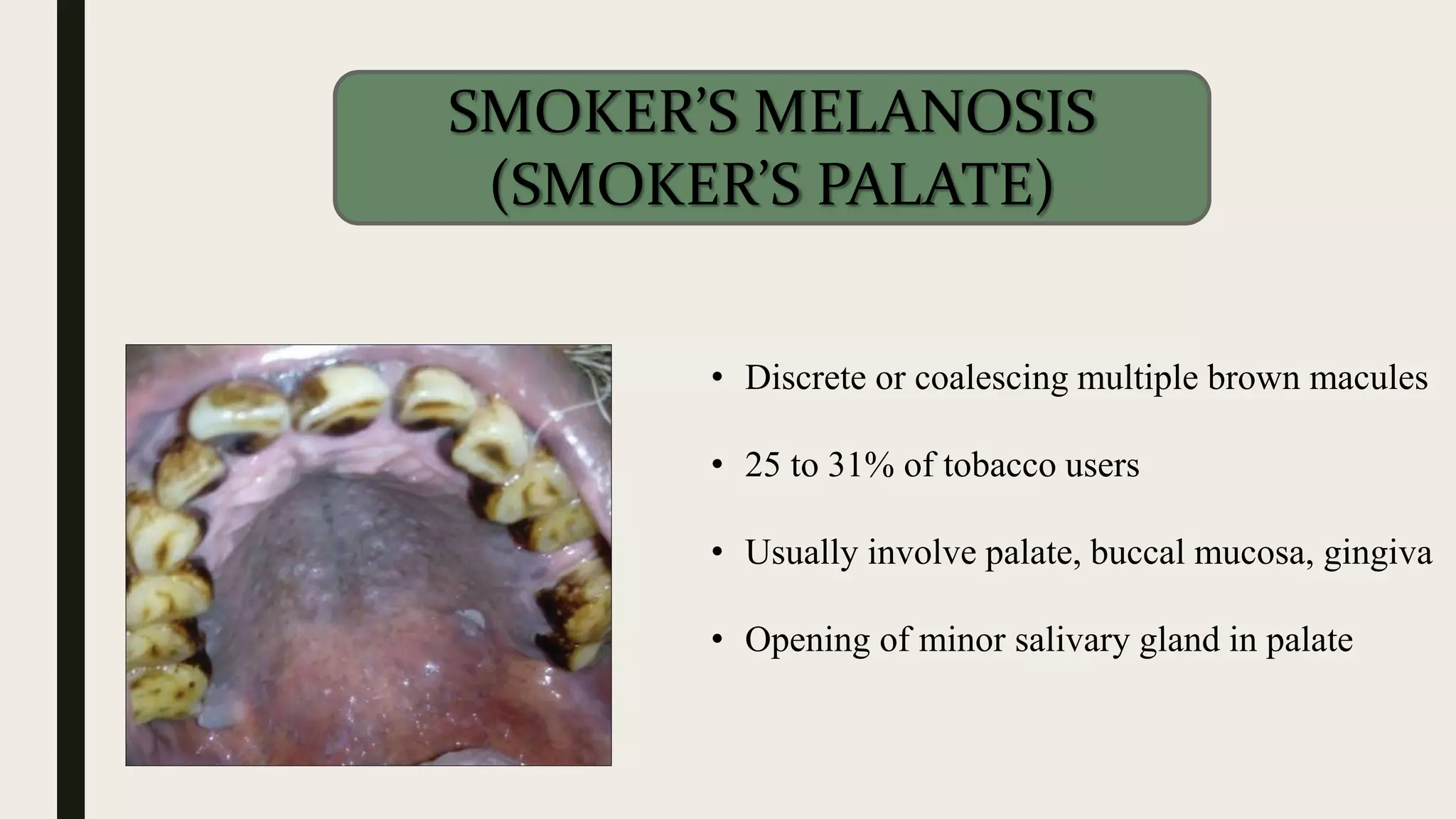 PIGMENTATIONS OF ORAL MUCOSA.pptx