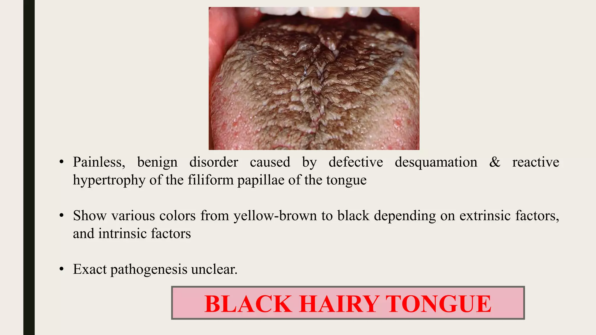 PIGMENTATIONS OF ORAL MUCOSA.pptx