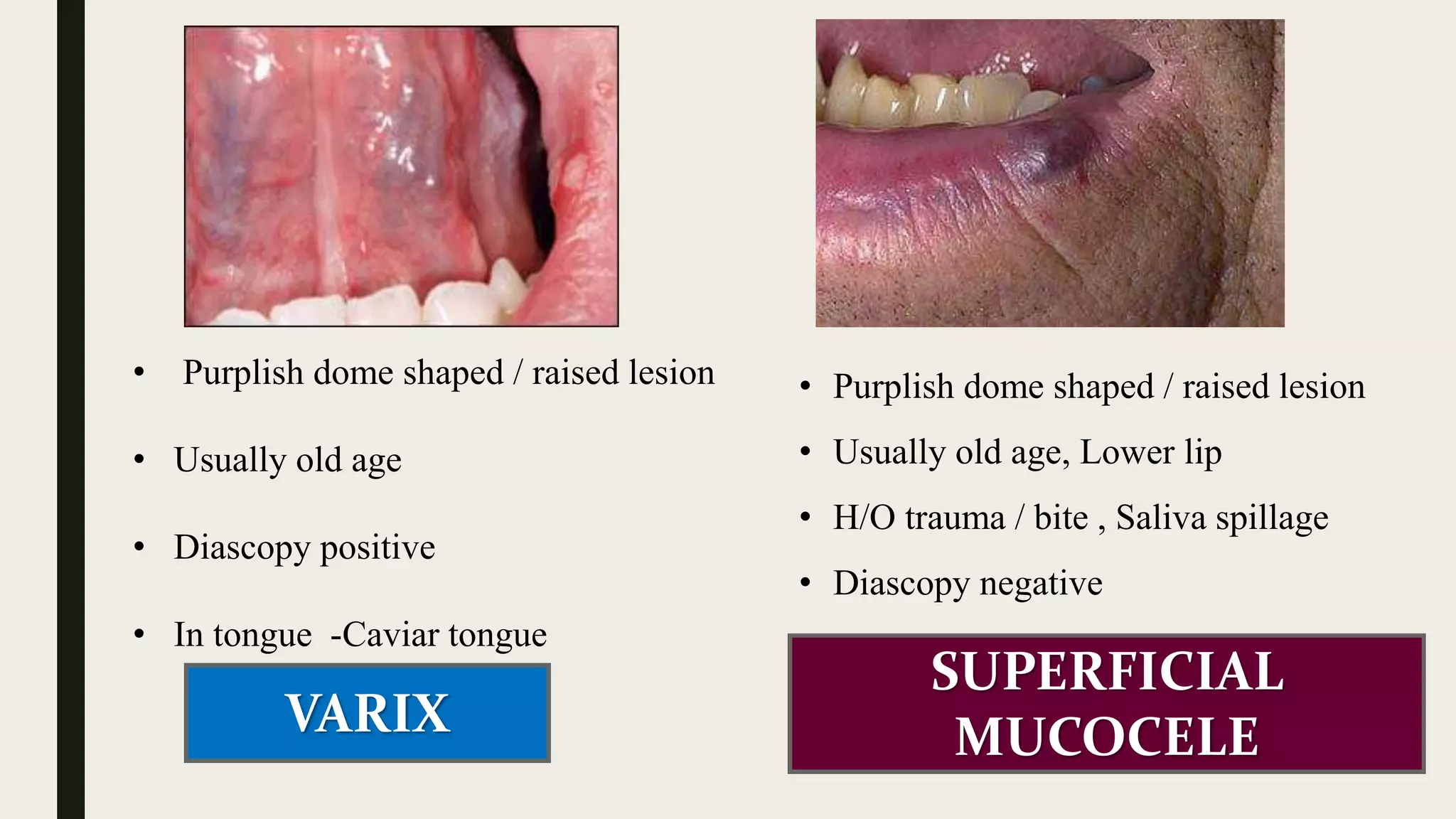PIGMENTATIONS OF ORAL MUCOSA.pptx