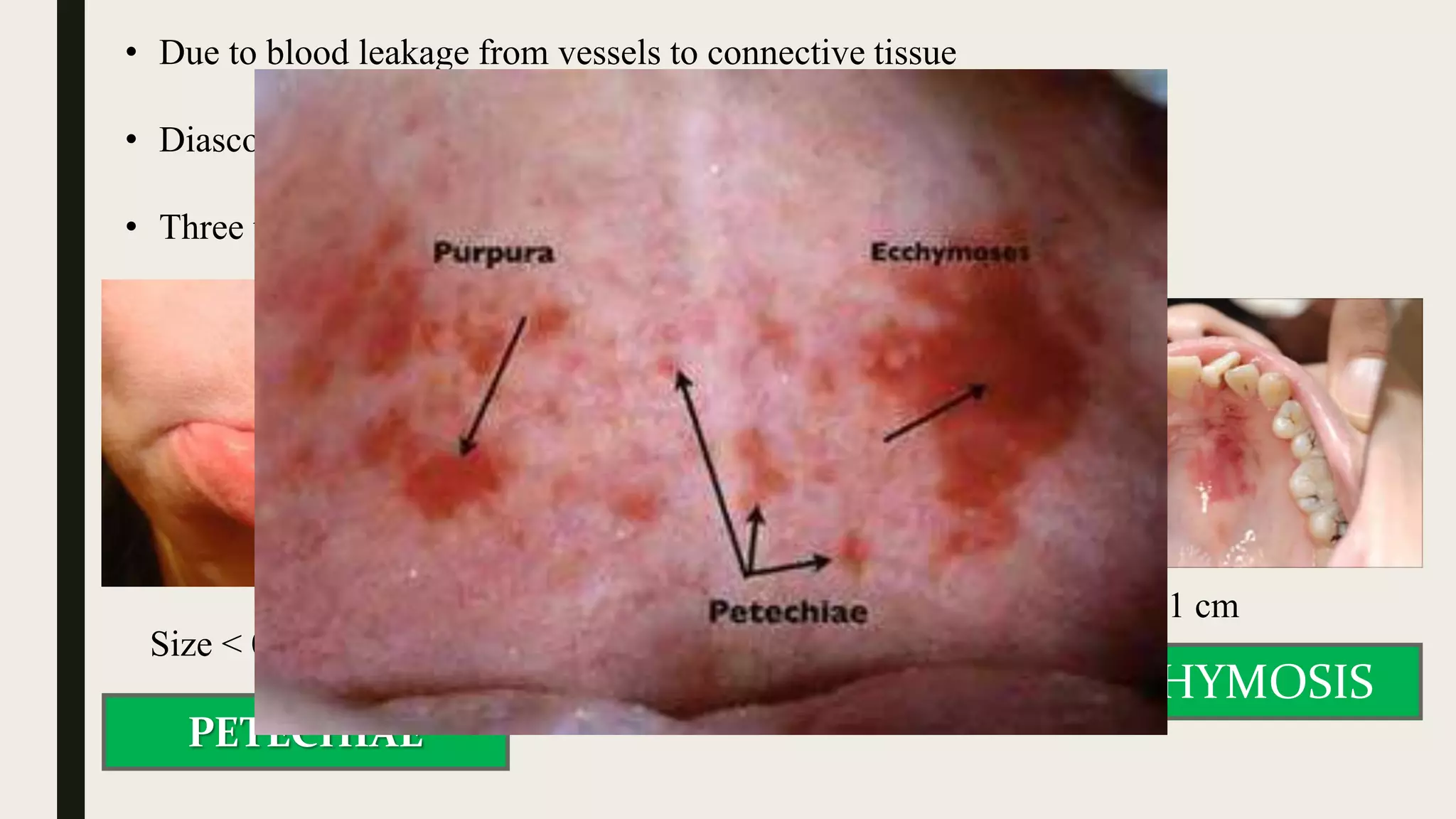 PIGMENTATIONS OF ORAL MUCOSA.pptx