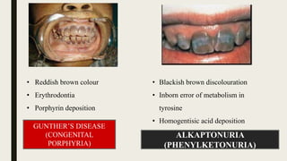 PIGMENTATIONS OF ORAL MUCOSA.pptx