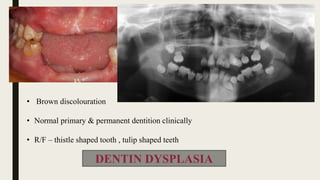 PIGMENTATIONS OF ORAL MUCOSA.pptx