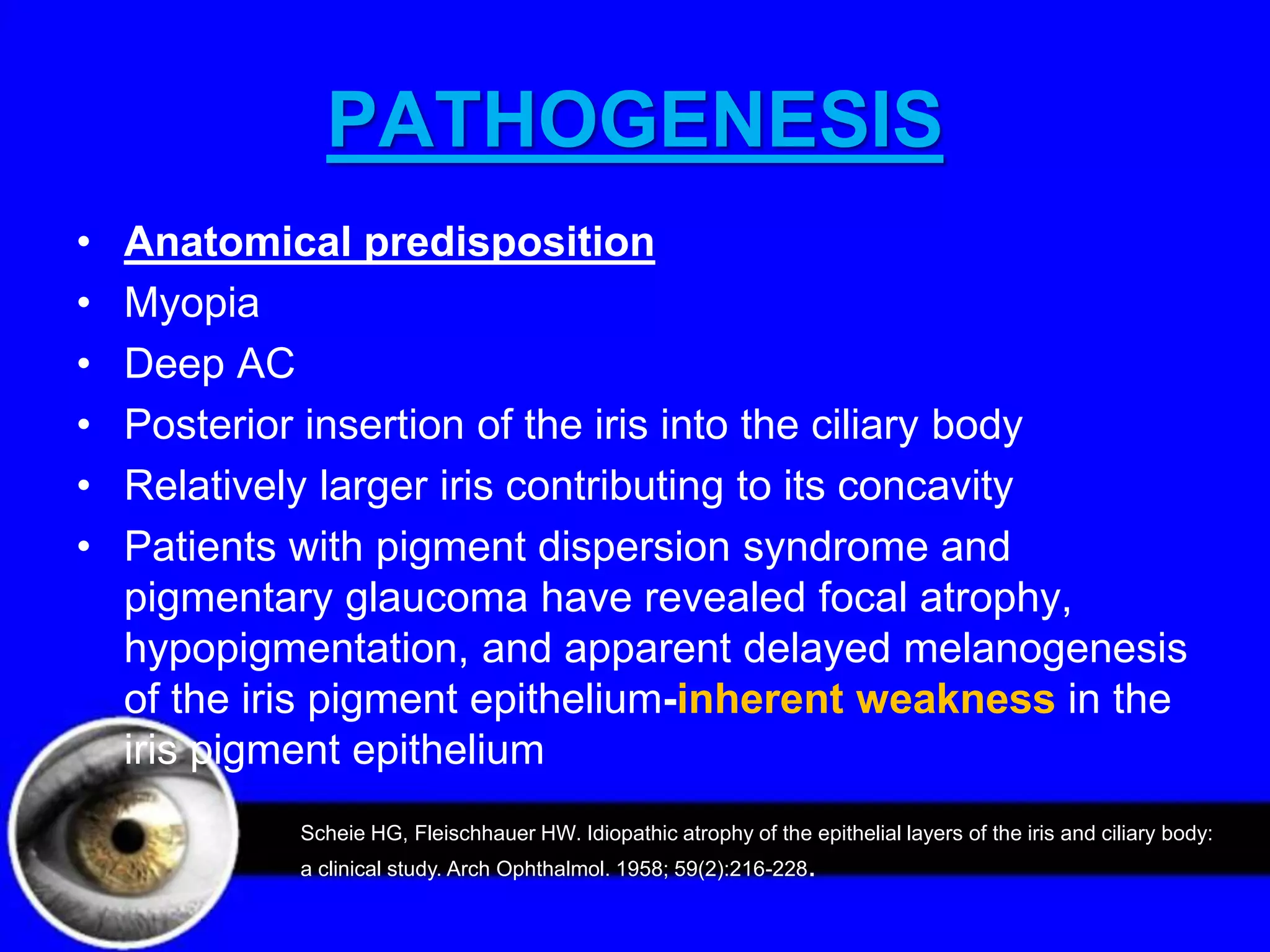 Pigment dispersion syndrome | PPTX