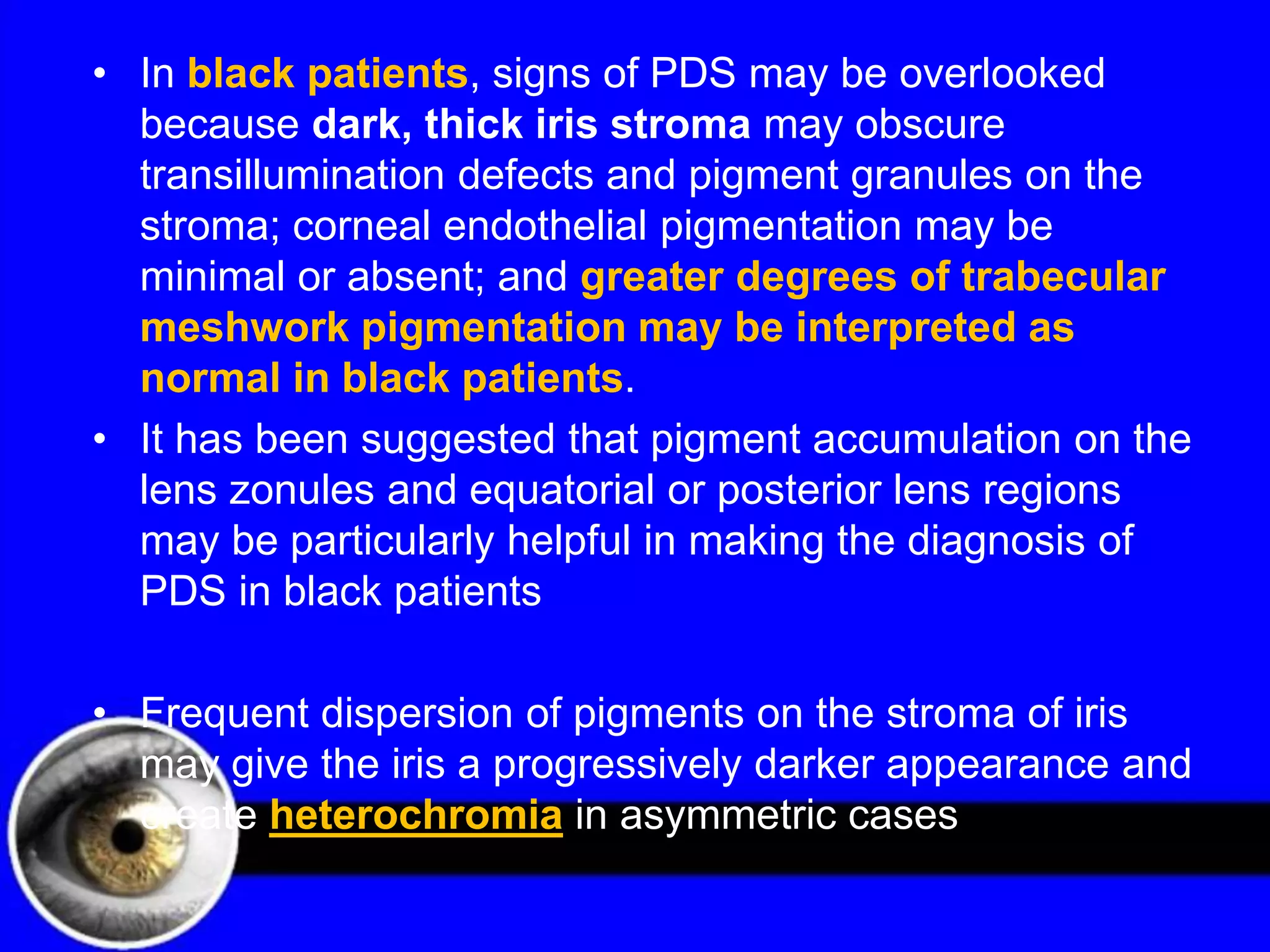 Pigment dispersion syndrome | PPTX