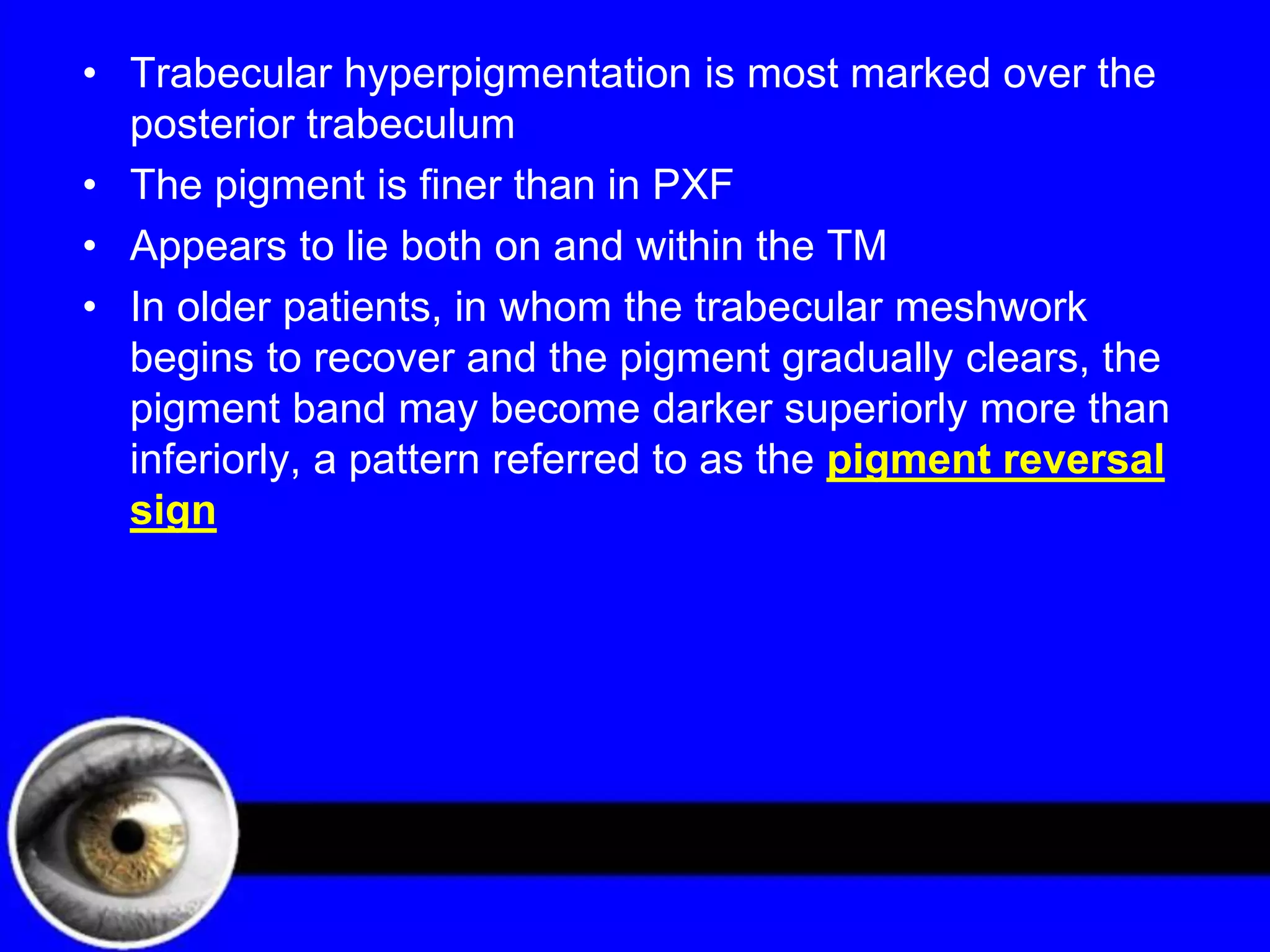 Pigment dispersion syndrome | PPTX