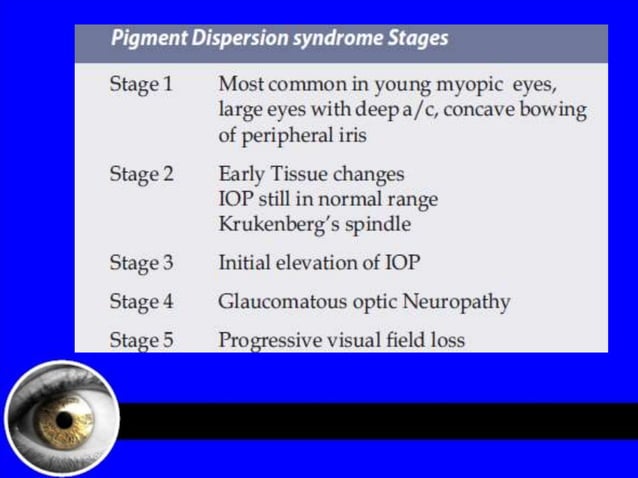 Pigment dispersion syndrome | PPTX | Eye and Vision Conditions ...