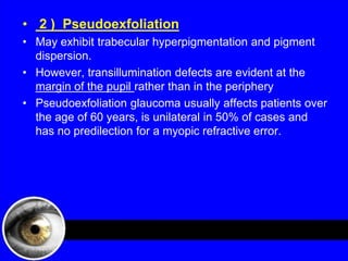 Pigment dispersion syndrome | PPTX