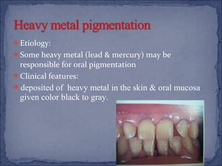 Pigmented lesion | PPT