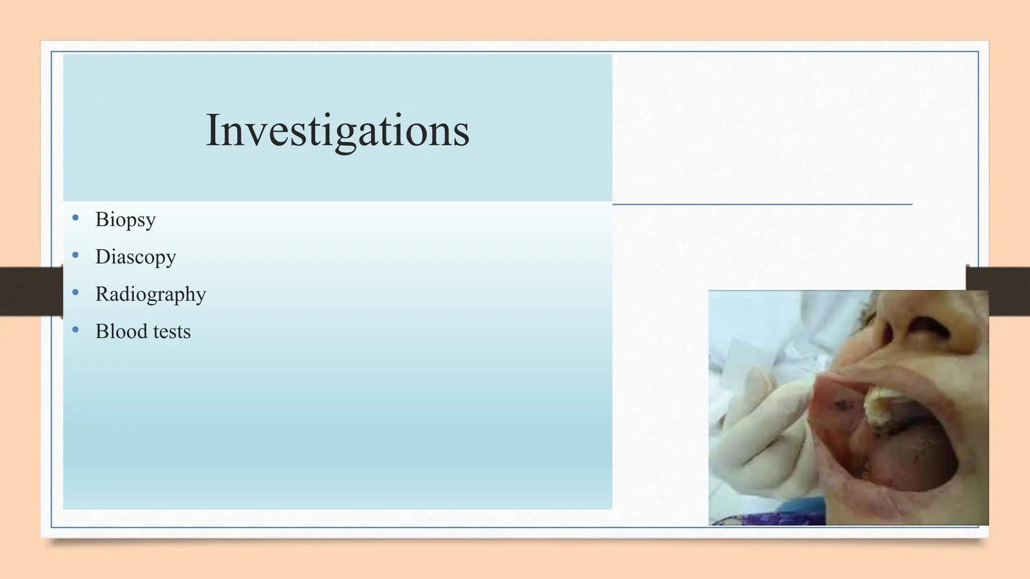 Exogenous and endogenous Pigmented lesion of oral cavity | PPTX