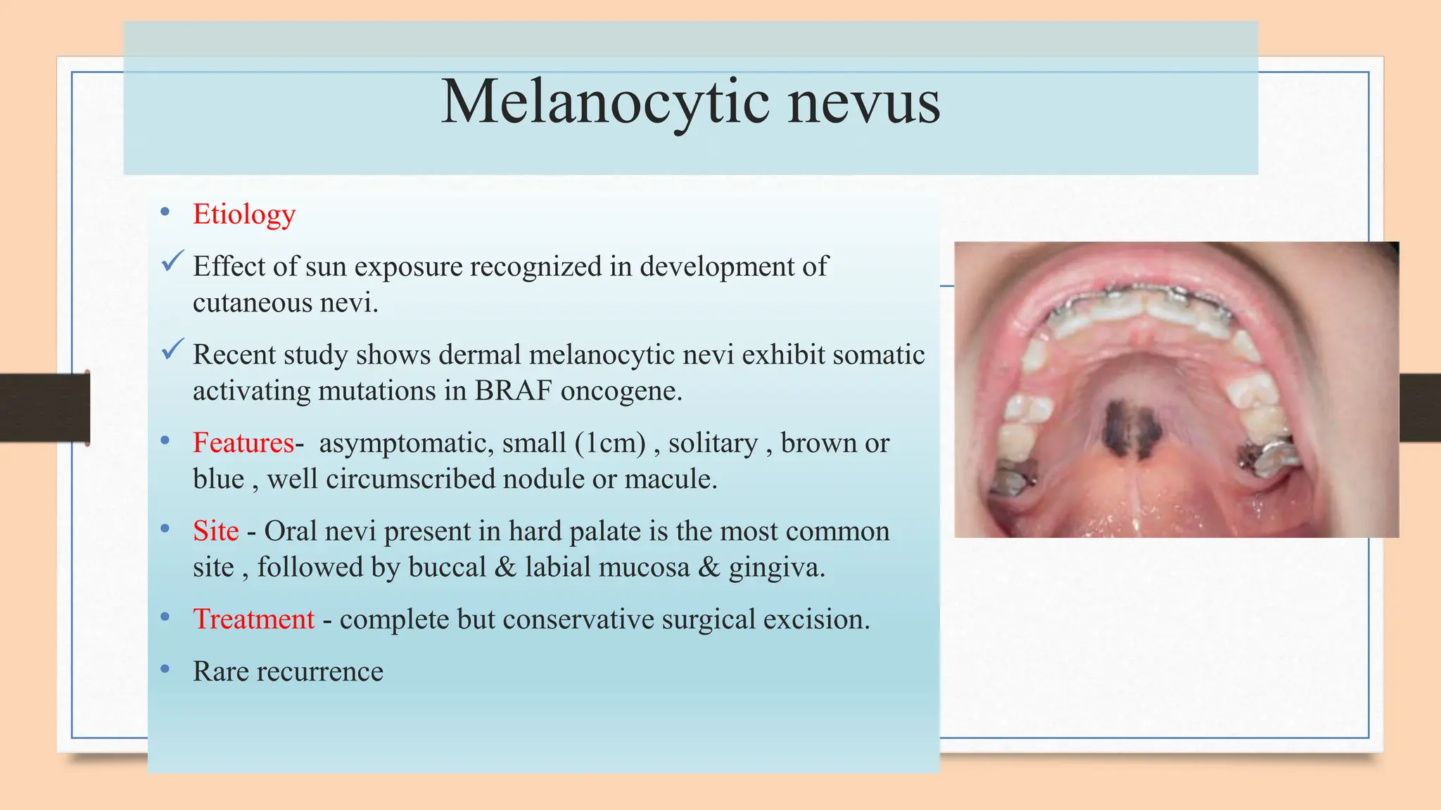 Exogenous and endogenous Pigmented lesion of oral cavity | PPTX