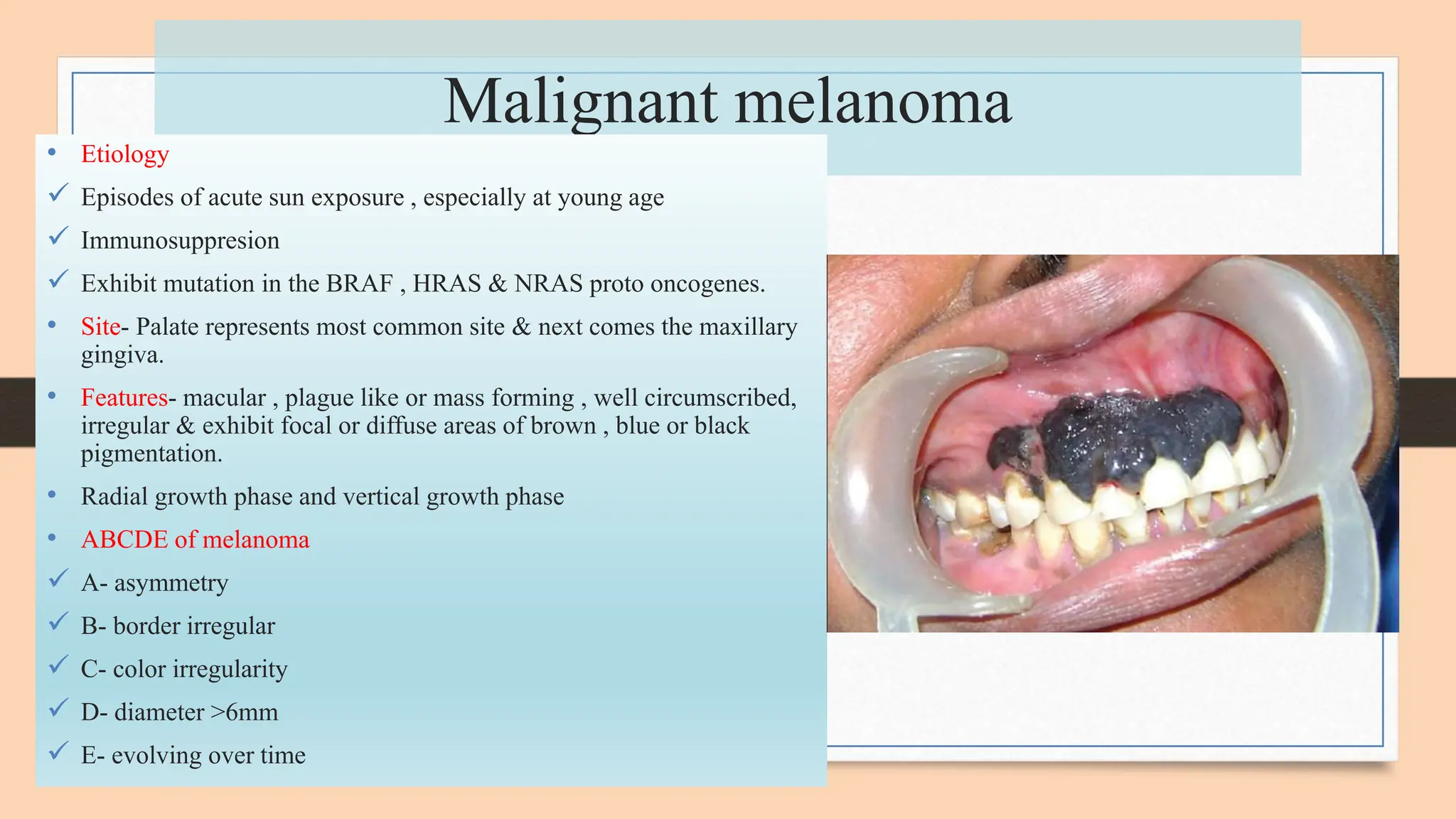 Exogenous and endogenous Pigmented lesion of oral cavity | PPTX
