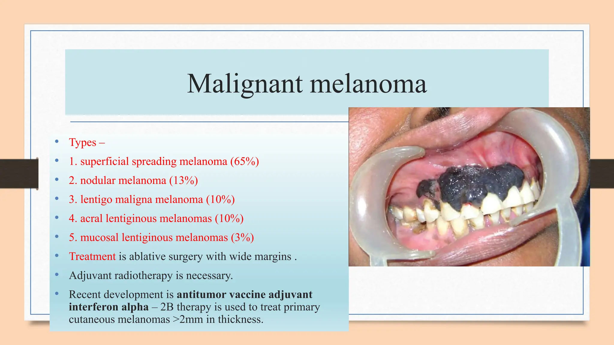 Exogenous and endogenous Pigmented lesion of oral cavity | PPTX