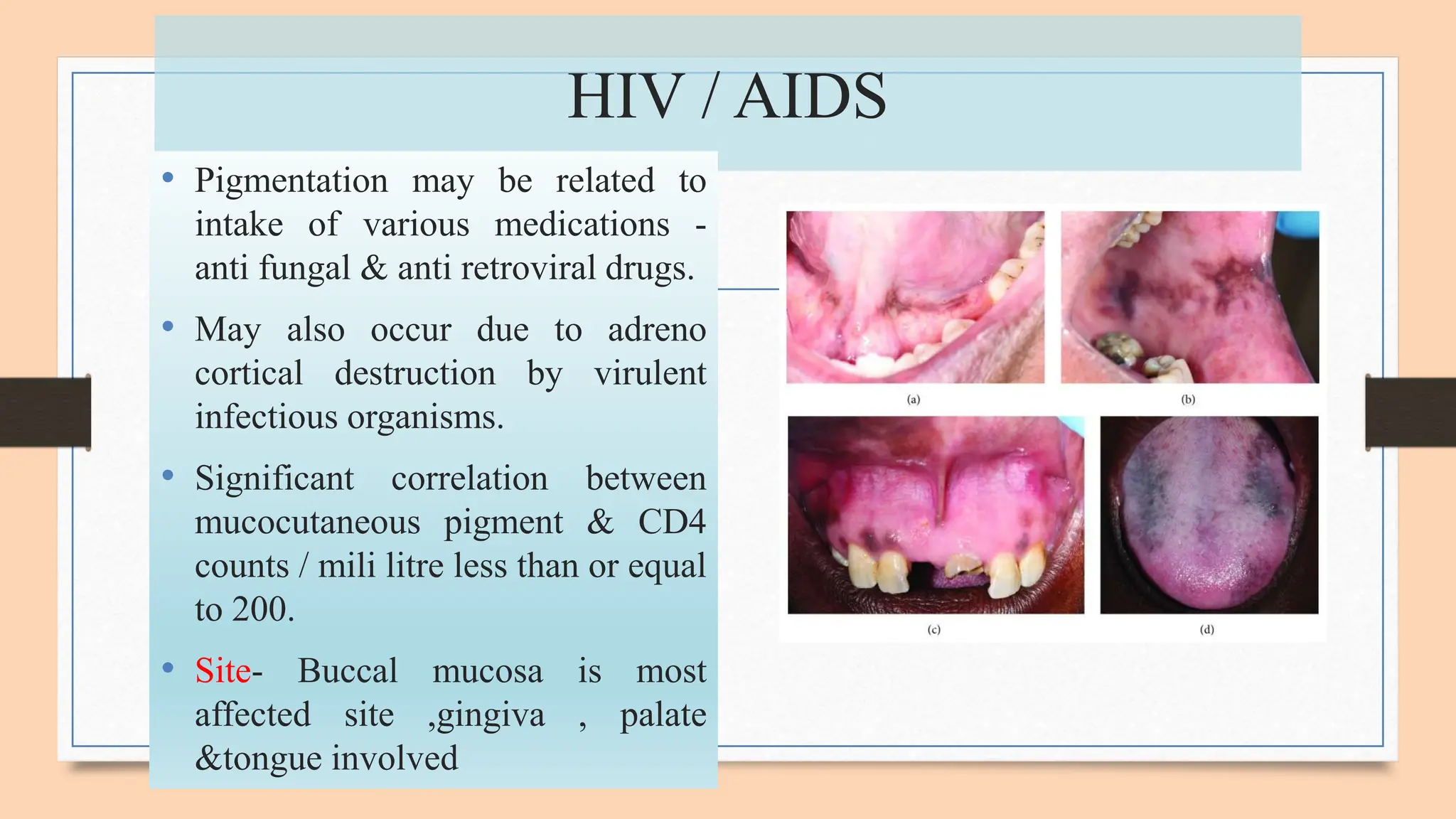 Exogenous and endogenous Pigmented lesion of oral cavity | PPTX