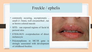Exogenous and endogenous Pigmented lesion of oral cavity | PPTX