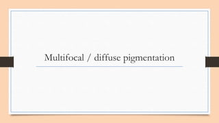 Exogenous and endogenous Pigmented lesion of oral cavity | PPTX