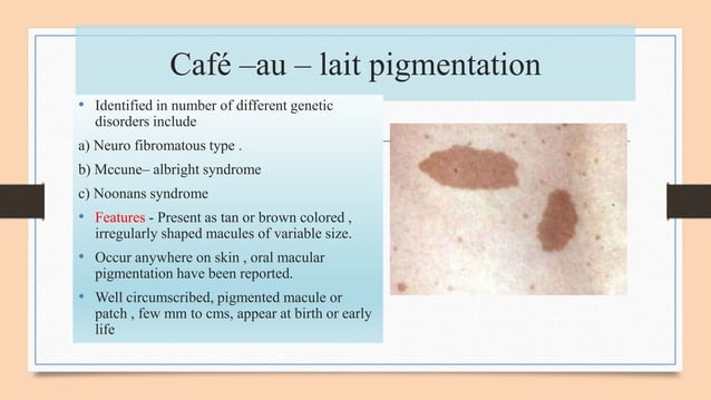 Exogenous and endogenous Pigmented lesion of oral cavity | PPTX | Skin ...