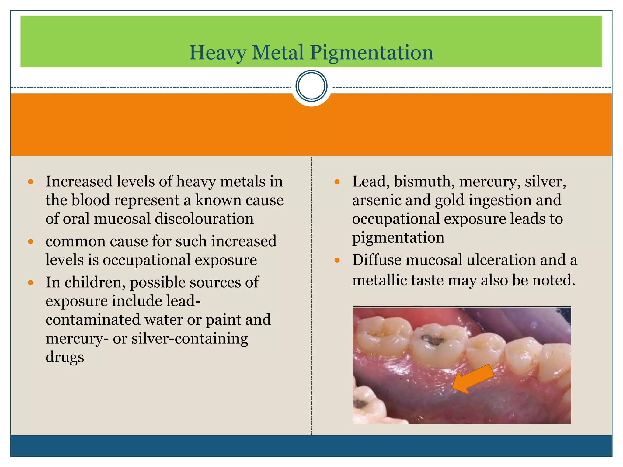 Pigmented lesions of oral cavity | PPTX