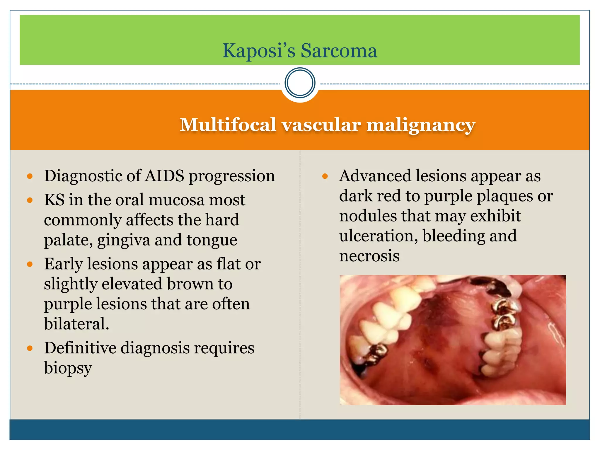 Pigmented lesions of oral cavity | PPTX