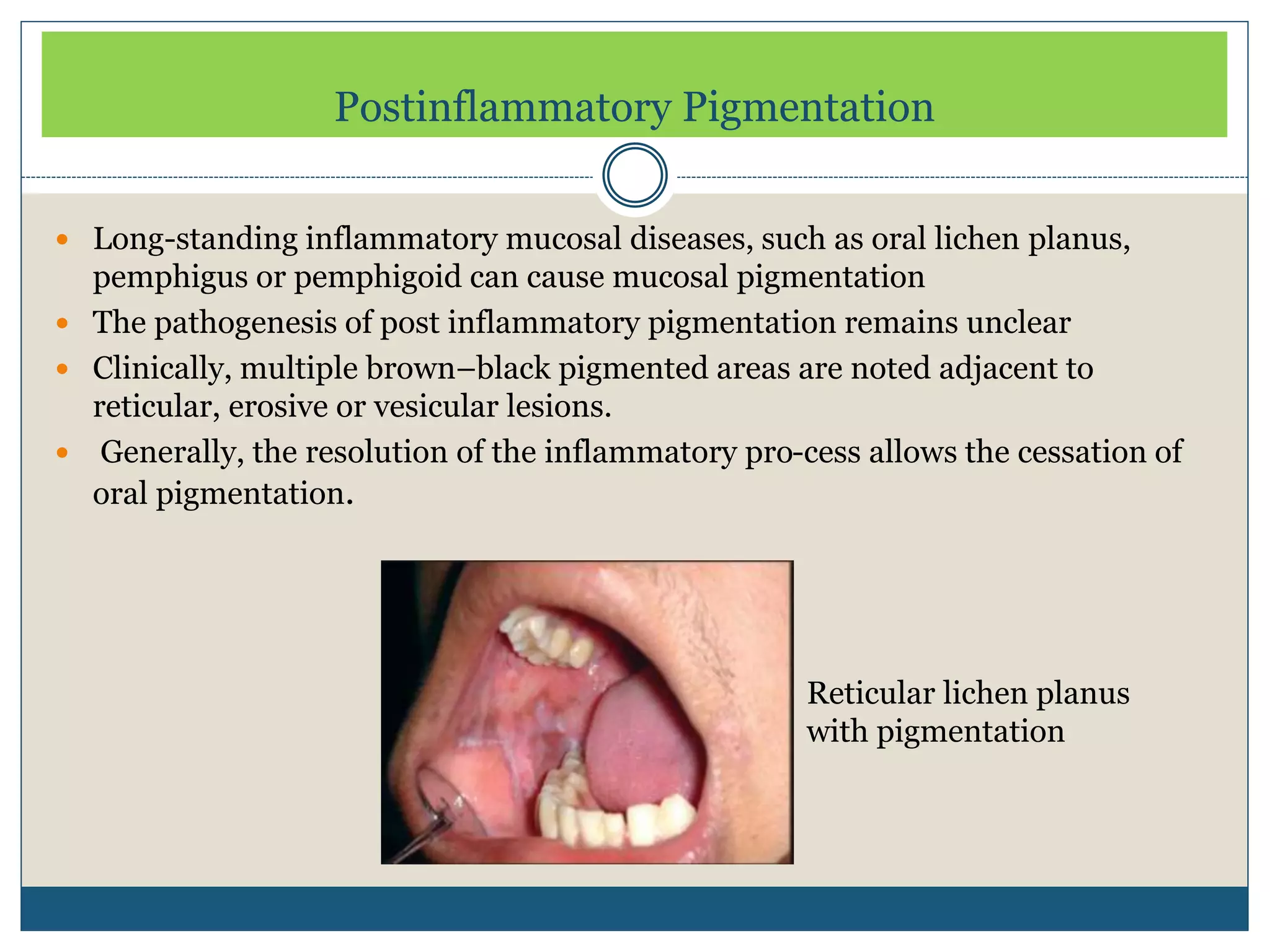 Pigmented lesions of oral cavity | PPTX