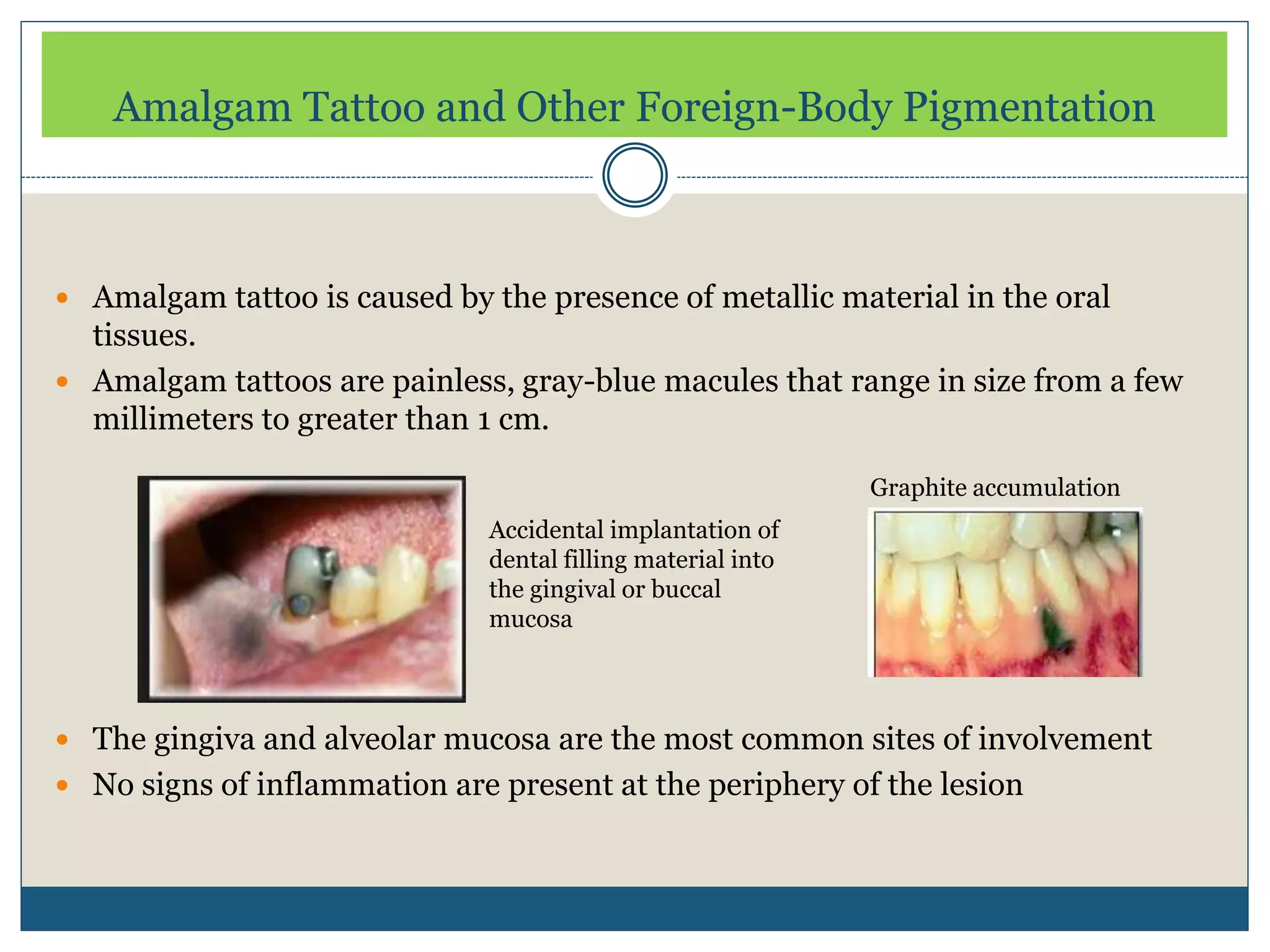 Pigmented lesions of oral cavity | PPTX