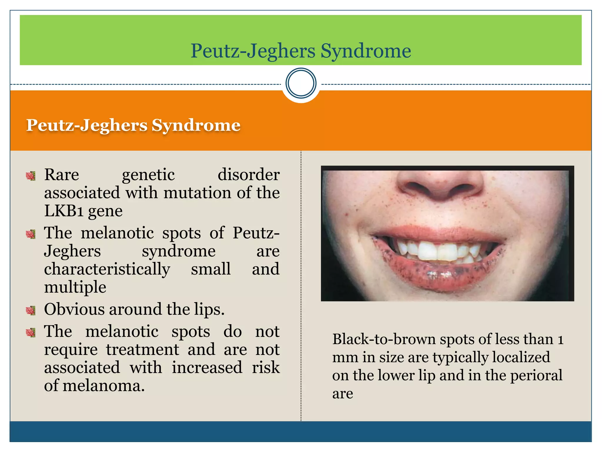 Pigmented lesions of oral cavity | PPTX