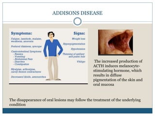 Pigmented lesions of oral cavity | PPTX