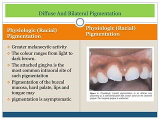 Pigmented lesions of oral cavity | PPTX