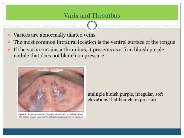 Pigmented lesions of oral cavity