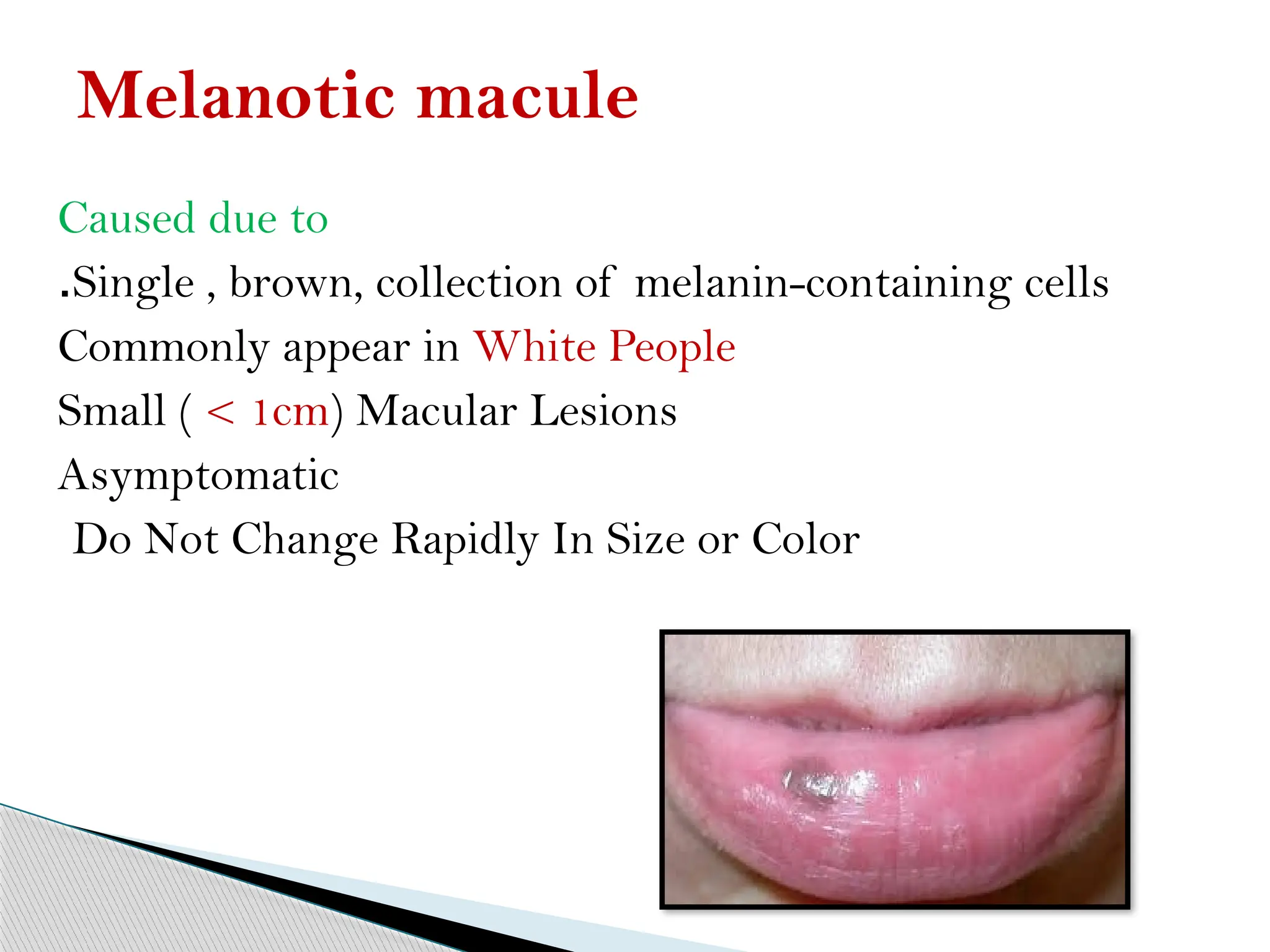 Pigmented lesions of oral cavity #4.pptx