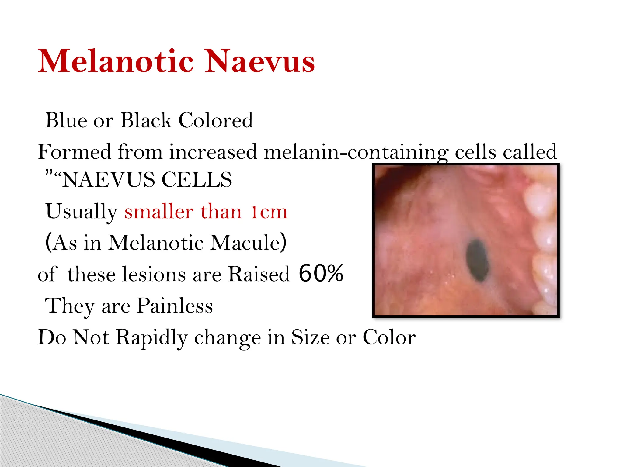 Pigmented lesions of oral cavity #4.pptx