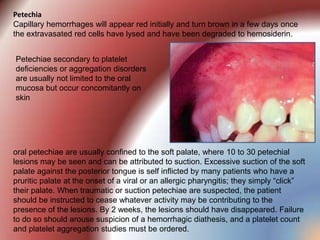 Pigmented lesions of oral mucosa | PPTX