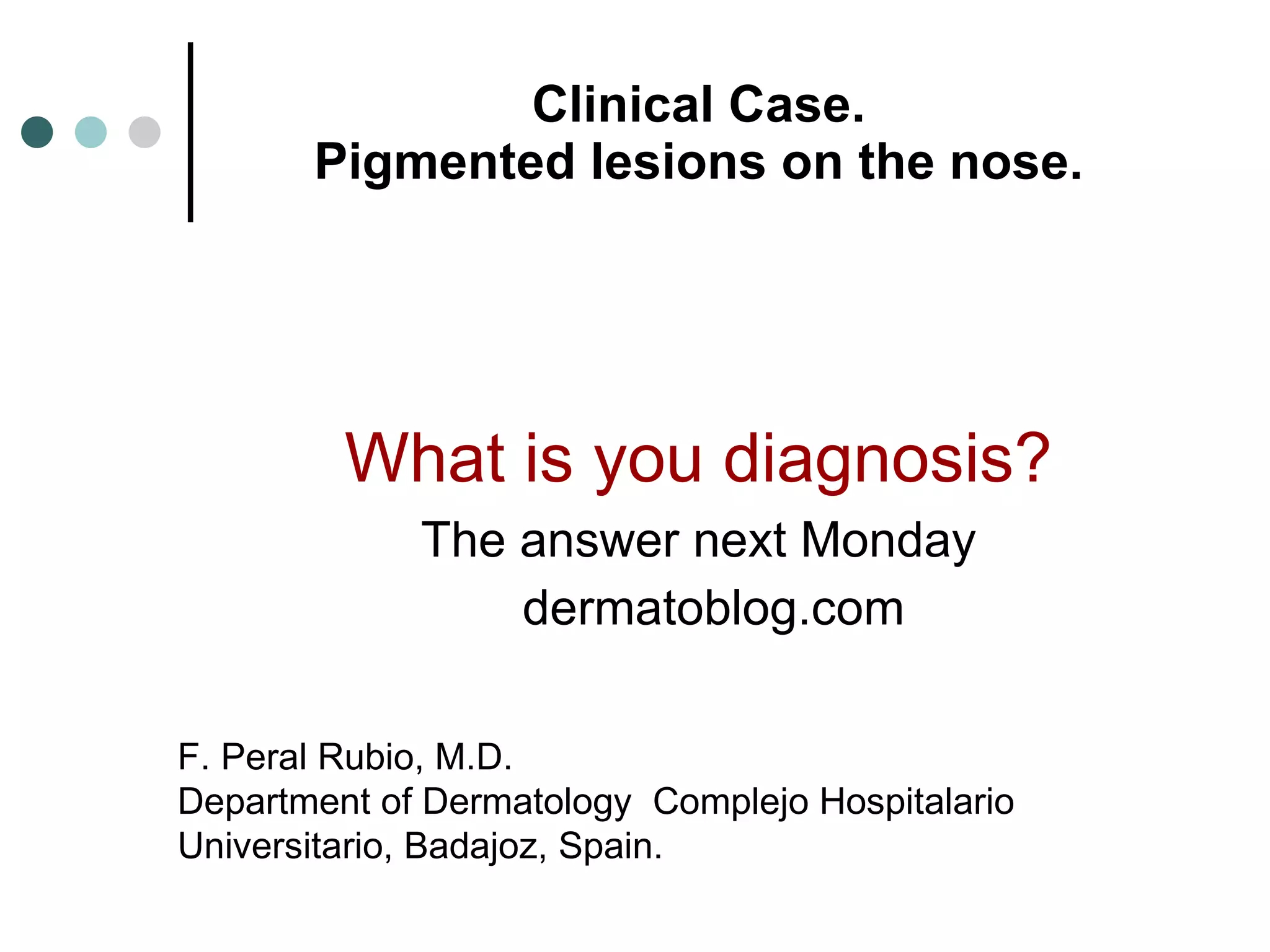 Pigmented Lesions On The Nose. | PPT