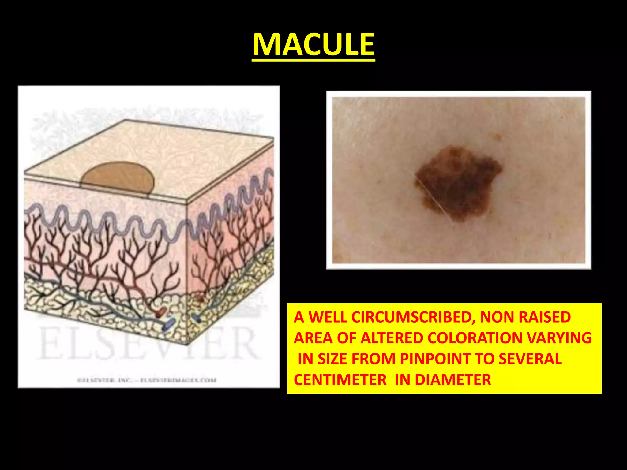 Pigmented lesions of oral cavity | PPTX
