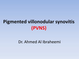 Pigmented villonodular snynovitis | PPTX