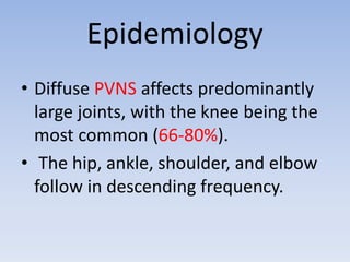 Pigmented villonodular snynovitis | PPTX