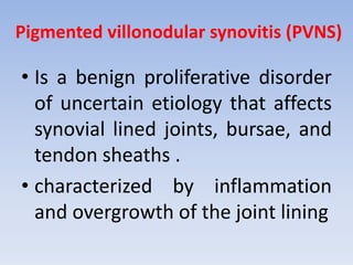 Pigmented villonodular snynovitis | PPTX