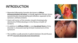 Pigmented Villonodular Synovitis (PVNS).pptx