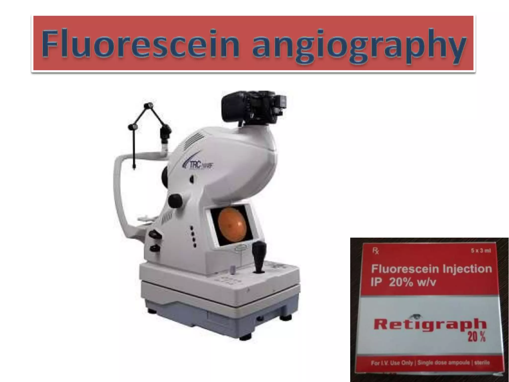 Pigment epithelial defect and intraretinal fluid | PPTX