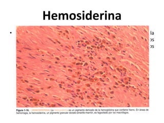 Pigmentos | PPTX | Blood Disorders | Diseases and Conditions