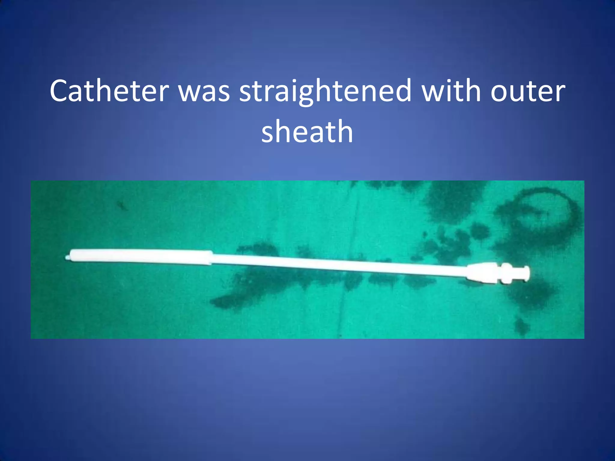 Pigtail catheter | PPTX