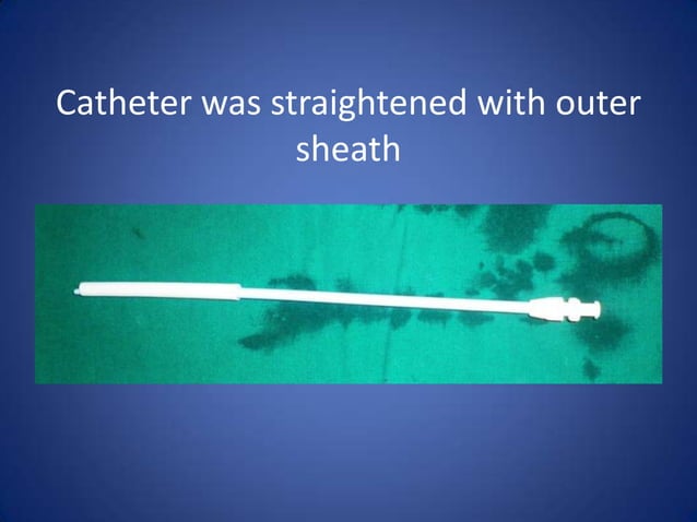 Pigtail catheter | PPTX | Medical Health