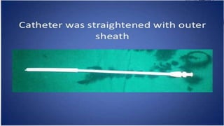 Pigtail catheter | PPTX