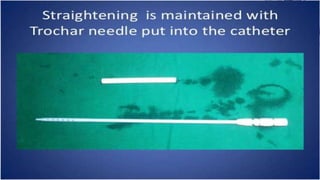 Pigtail catheter | PPTX
