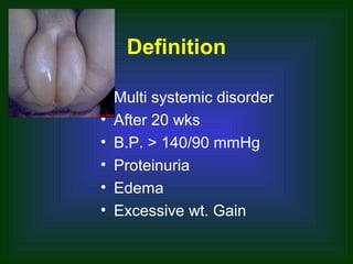 Pih and eclampsia | PPT