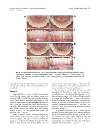 20 Year follow up of lingually bonded retainers | PDF
