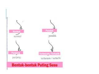 PIJAT LAKTASI&OKSITOSIN.ppt................ | PPT